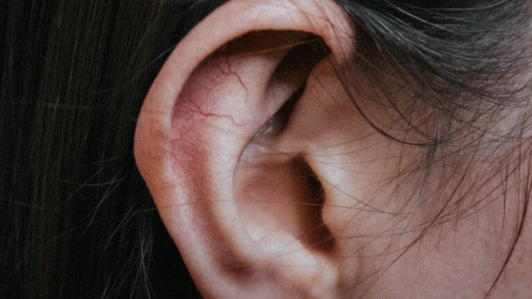 Psoriasis Ear – How to treat it with natural remedies - TheWellthieone